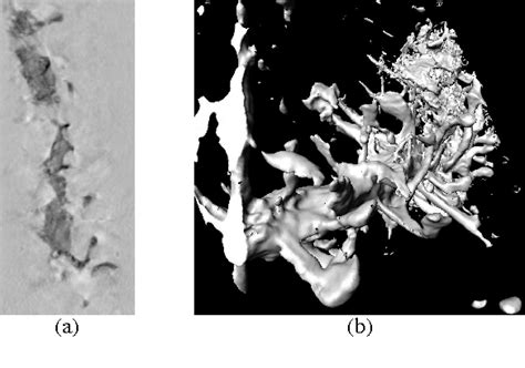 Figure 1 From A Framework For Level Set Segmentation Of Volume Datasets