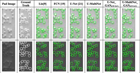 Figure 1 From Detection Of Conductive Particles In Tft Lcd Circuit Using Generative Adversarial
