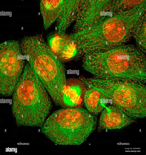 Mitosis Confocal Light Micrograph Of Hela Cells During Mitosis