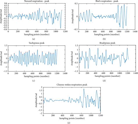 Figure 10 From Frequency Modulated Continuous Wave Radar Respiratory Pattern Detection