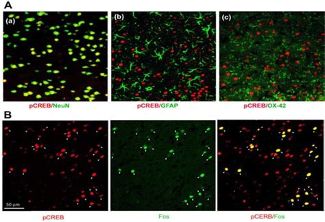 Double Immunofluorescence Reveals That Pcreb Red Colocalizes With