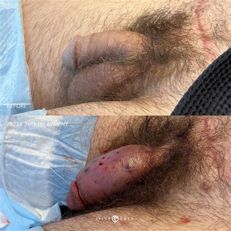 230801 Jason Emer Male Clinic
