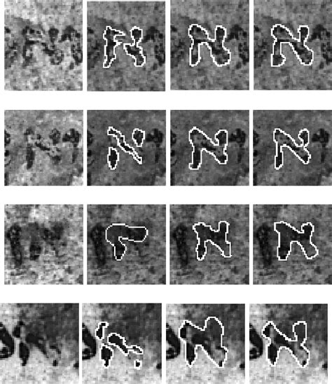 Figure 1 From Global And Local Shape Prior For Variational Segmentation