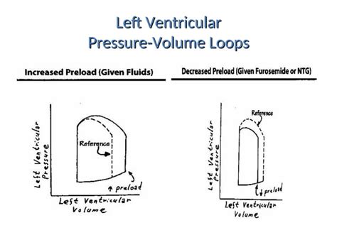 Presentation Of Left Ventricular Pressure Volume Loops For Dummies Ppt