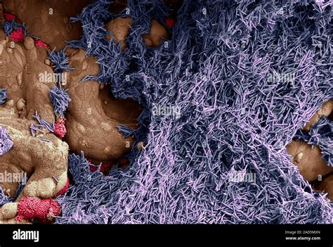 Citrobacter Rodentium Infected Mouse Colon Coloured Scanning Electron Micrograph Sem Showing