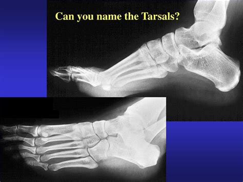 PPT Functions Of The Skeletal System PowerPoint Presentation Free Download ID 707013