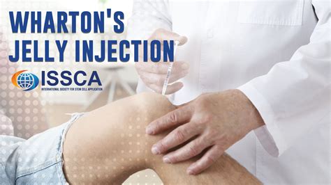 Whartons Jelly Injection Issca™ International Society For Stem