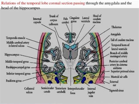 Approach To Temporal Lobe Anatomy Function Epilepsy Mri Finding