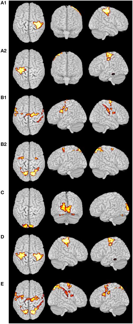 Clustering Results From Real Fmri Data The Clusters A1a2d Were Download Scientific