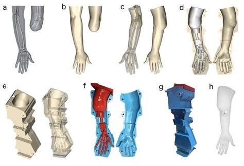 Design And Fabrication Process For The Prosthetic Arm A The Affected