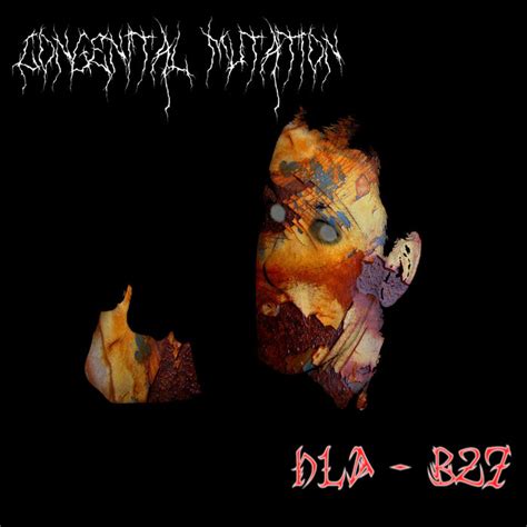 Hla B27 Congenital Mutation