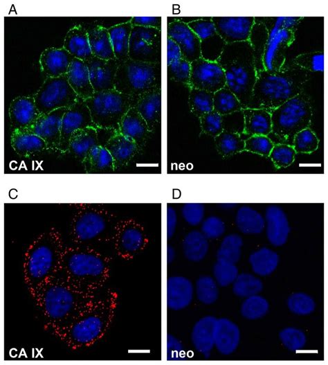 Co Localization Of Adam10 And Ca Ix In C33a Fl Ca Ix Cells