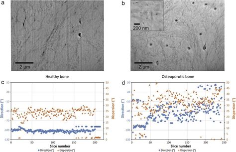 Cross Sectional FIB SEM Images Of A Healthy And B Osteoporotic Bone Download Scientific
