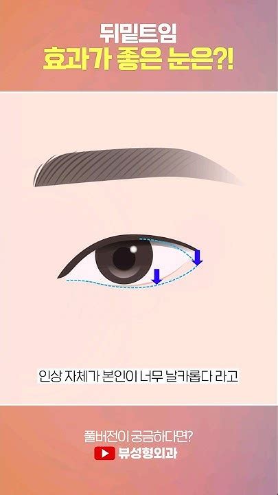 뒤밑트임하면 대박나는 눈 듀얼트임 Youtube