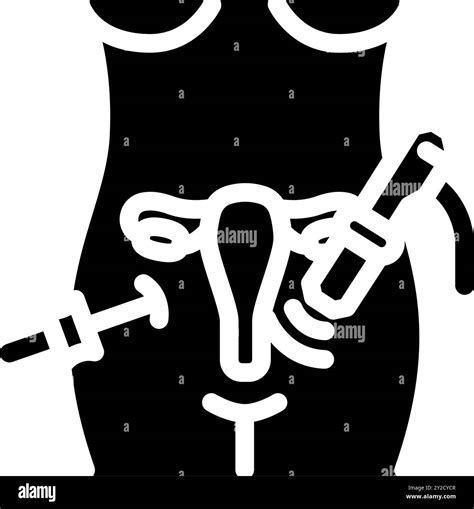 Gynecologic Laparoscopy Surgery Glyph Icon Vector Illustration Stock Vector Image And Art Alamy