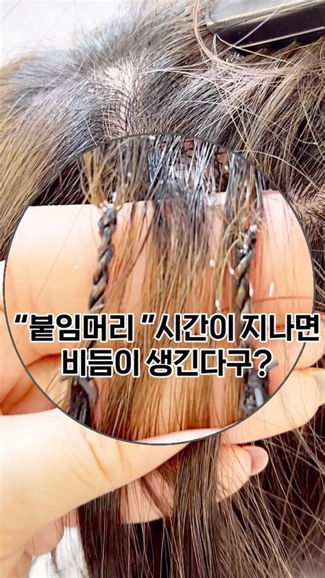 인천붙임머리구월동붙임머리어도러블붙임머리 •붙임머리 시간지나면 보이는 하얀색 비듬이 생긴다구 바로 헤어캐스트 라고 합니다 헤어 캐스트는 모근을 둘러싸고 있는