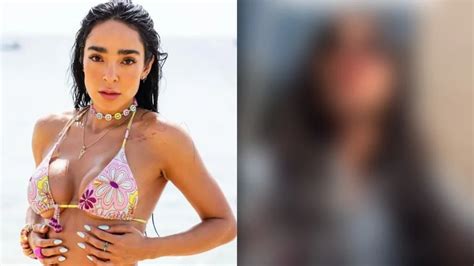 Manelyk Gonz Lez Muestra C Mo Luce Su Rostro Tras Un Mal Tratamiento Est Tico Que Pudo Dejarla