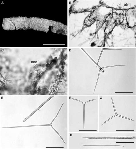 Cross Section Of Sycon