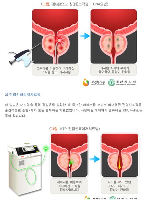 10 남성의 성 기능과 성 접촉 병 네이버 블로그