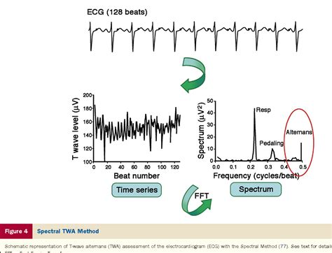 Figure 1 From Microvolt T Wave Alternans Physiological Basis Methods