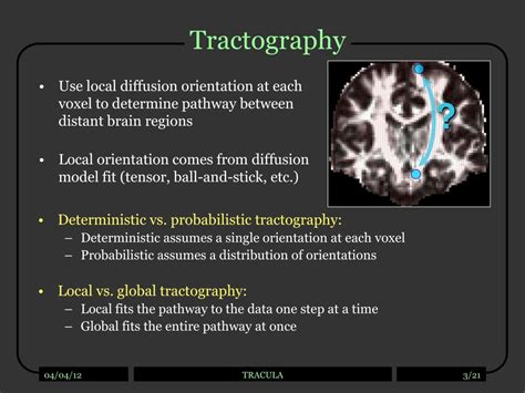 Ppt Tracula Powerpoint Presentation Free Download Id6673755