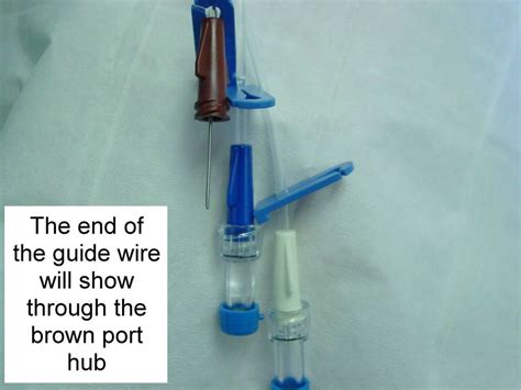 Clinical Notes Central Line Placement A Step By Step Procedure Guide With Photos