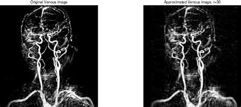 Figure 1 From Exact Recovery Low Rank Matrix Via Transformed Affine