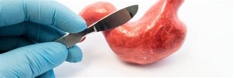 Understanding The Risks And Benefits Of Gastric Bypass Reversal