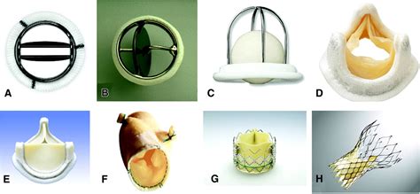 Cardiac Computed Tomography For Prosthetic Heart Valve Assessment An