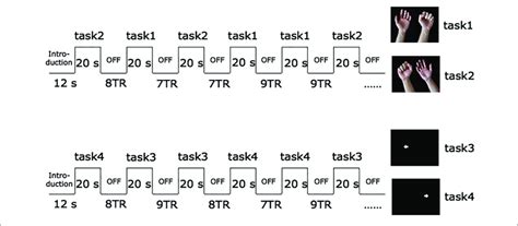 Schematic Diagram Of Fmri Experimental Paradigm The Arrow Pointing Download Scientific