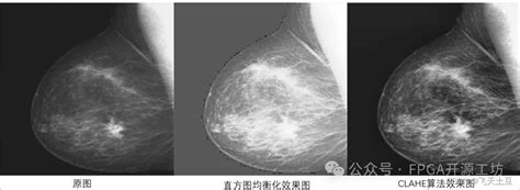Clahe算法上新fpga Clahe Csdn博客