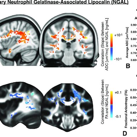 A Anatomic Localization Of Regions In The Brain Exhibiting A