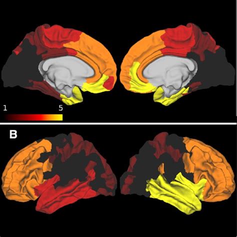 K Means Clusters Of Cortical Volumes For A Ftld Tau And B Ftld Tdp Download Scientific Diagram