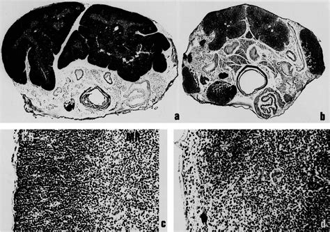 Thymus Involution In Balbc Mice Infected With Mhv A59 Whole