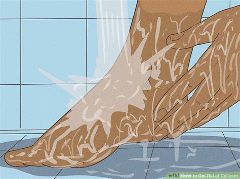 Ways To Get Rid Of Calluses WikiHow