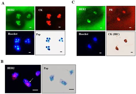 Subtyping Of Ctcs By The Current Cytology Based Ctc Detection Method