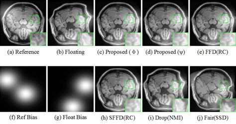 Registration Results Of Brain With Additive Distortion F And G Are Download Scientific