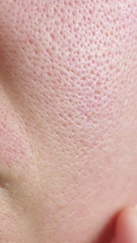Pores On Our Face Reduce Pores Enlarged Pores Reduce Pores Enlarged Pores Reduce Pore Size