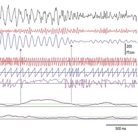 Pdf Phase Synchrony Among Neuronal Oscillations In The Human Cortex