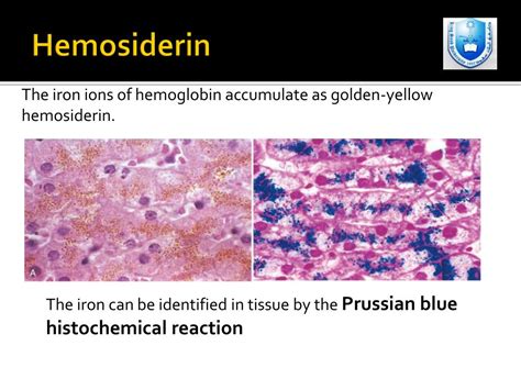 Ppt Intracellular Accumulations And Calcification Powerpoint