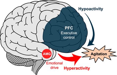 An Overview Of The Pathophysiology Of Agitation In Alzheimers Dementia