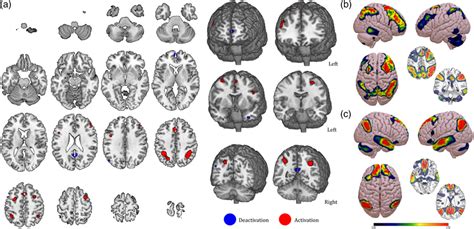 Increase And Decrease During The N‐back Task A Activation Red And