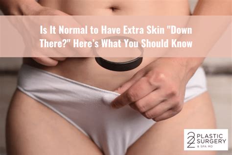 Is Extra Skin Down There Normal What You Should Know