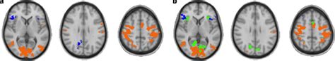 Standard Glm Analyses A Clusters For Simple Glm Orange Clusters