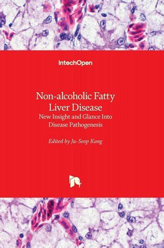 Non Alcoholic Fatty Liver Disease New Insight And Glance Into Disease