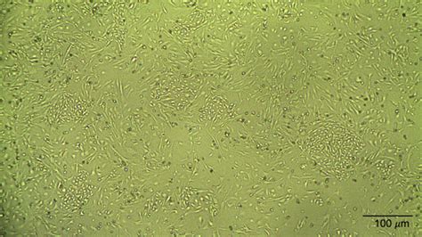 Isolation Of Primary Mouse Lung Endothelial Cells