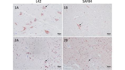 Intracellular Prp Sc Accumulation In Brain Sections Of Moose With Cwd Download Scientific
