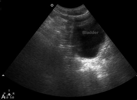 Emergent Ultrasound Procedures Clinical Tree