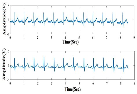 Original Ecg Signal And Filtered Output Of 8 Th Order Chebyshev Lpf