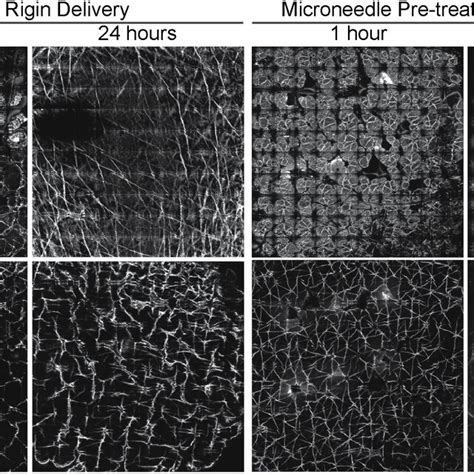 LSCM Images Of Rigin Delivery Into Excised Human Skin Representative Download Scientific